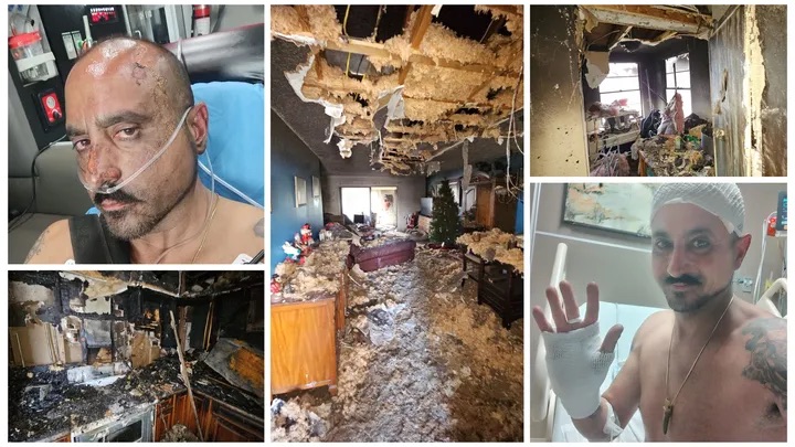 Melbourne Officer Rescues Beloved Dog from House Fire, Sustains Severe ...